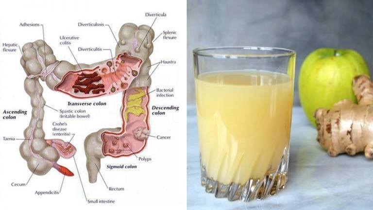 Desalojar el intestino con un jugo verde especial y saludable